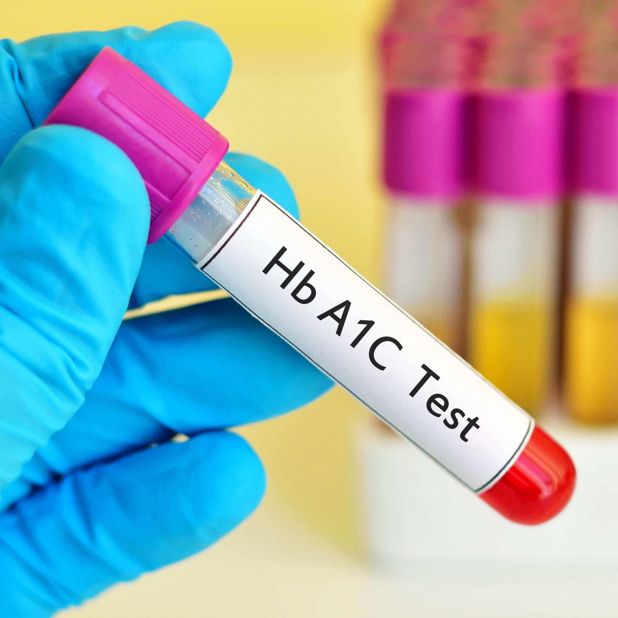 Hemoglobin A1c Test – Good Seep Diagnostics