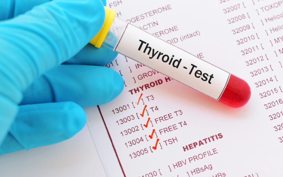 Thyroid Function Test (TSH) – Good Seep Diagnostics