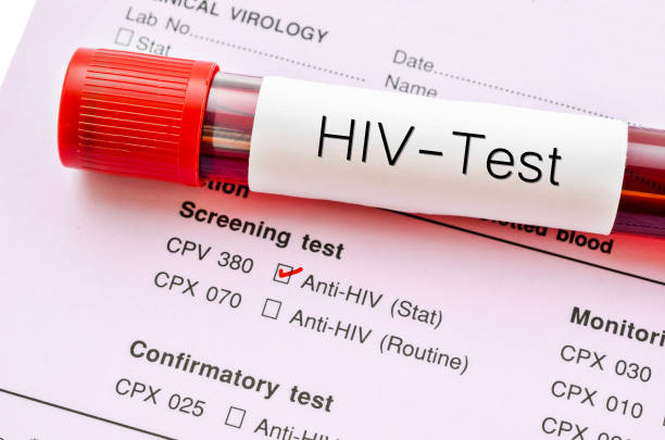 HIV Test – Good Seep Diagnostics